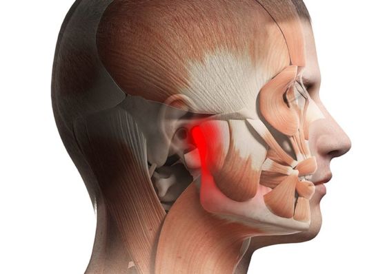 TMJ Ankylosis Pain | Locked Jaw Treatment by Best Oral Surgeon - Dr ...